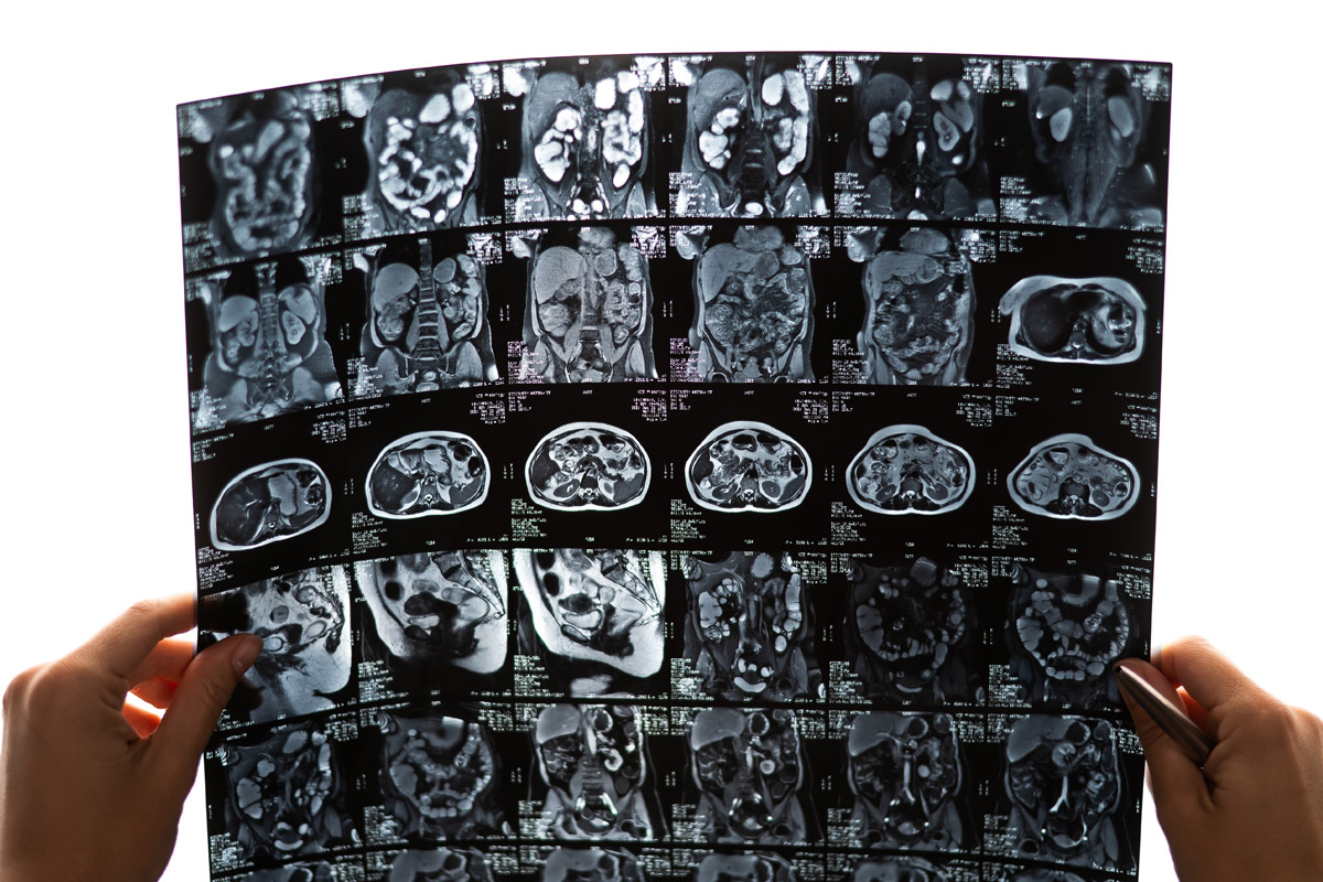 MRI בטן, בדיקת mri בטן, רופאים מומחים ברדיולוגיה RD